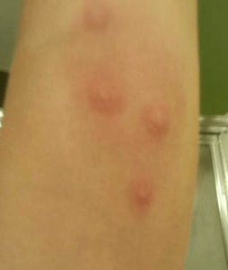 Do Cockroaches Bite? - Pest Control Gurus